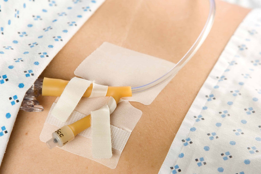 CATH-SECURE Dual Tab Multi-Purpose Tube Anchoring Device – BuyMedical.com